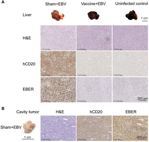 Tiantan Vaccinia Virus Based Ebv Vaccines Targeting Both Latent And