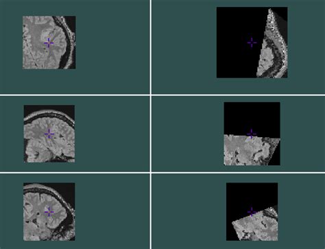 Help In Applying Rotation Using Affinematrix Algorithms Itk