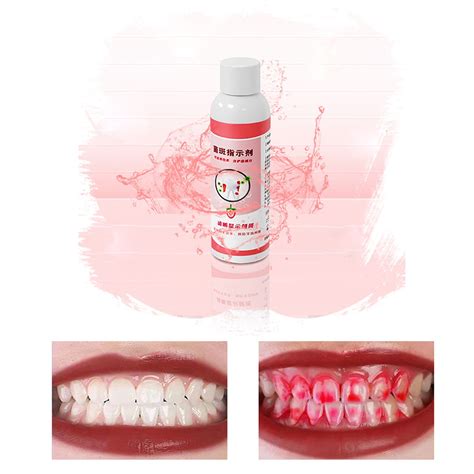 Plaque Disclosing Agent 60ml Dental Plaque Indicator With Scale Cup Oral Tartar Test