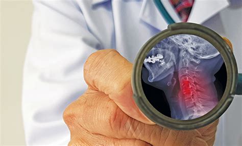 Chiropractic And Neck Pain The Womens Journal