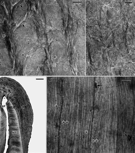 An Alternate Lamellar Pattern In A Longitudinal Section By Transmission