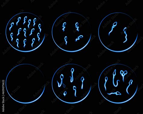Vector Isolated Illustration Of Sperm Pathologies Spermogram Sperm Defects Defects Of The
