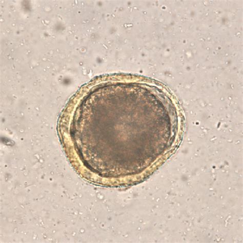 Parasiteegg Identification Flashcards Quizlet