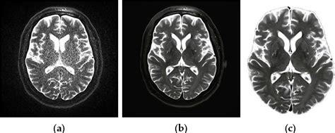 Figure 2 From Feature Extraction Using A Residual Deep Convolutional Neural Network Resnet 152