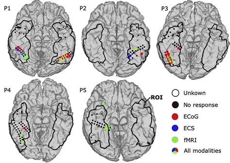 Fusiform Face Area Diagram