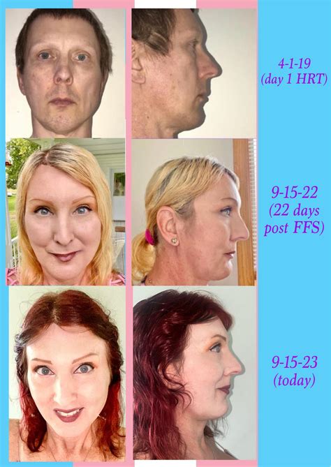 The Journey As It Stands Diane M2f 54 Months Hrt Age 58 R