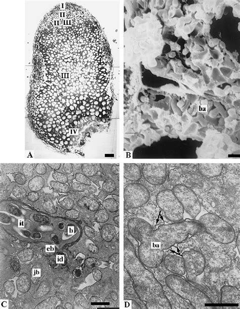 A±d Nodule Morphology And Bacteroid Ultrastructure In The Wild Type