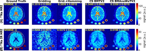 New Paper Influence Of Image Contrasts And Reconstruction Methods On