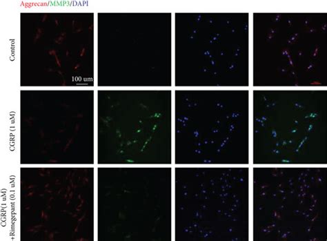 Novel Cgrp Receptor Antagonist Rimegepant Could Ameliorate
