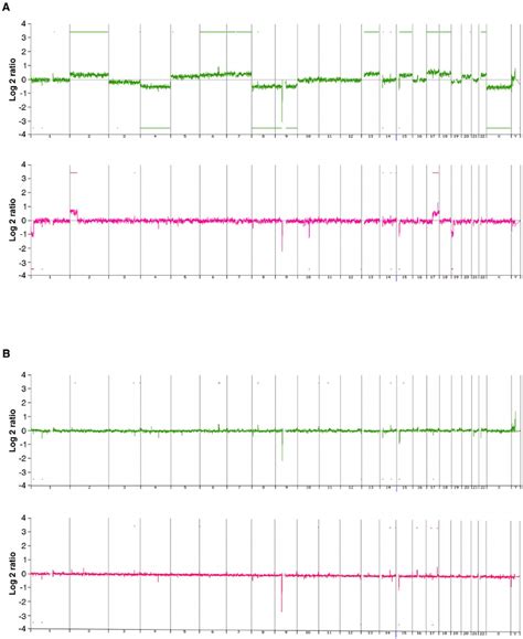 Array Cgh Copy Number Profiles Of Tumor And Constitutional Dna Samples