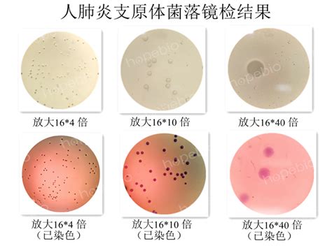 人肺炎支原体菌落镜检结果 微生物图片 青岛海博生物