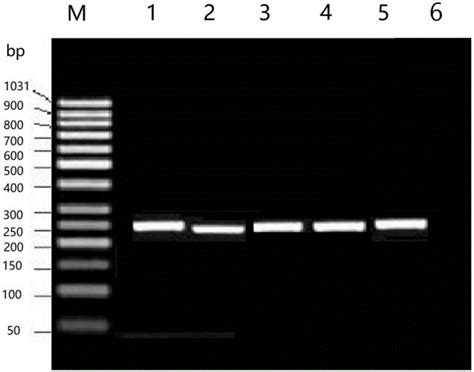 宫颈癌生物标志物检测试剂盒的制作方法