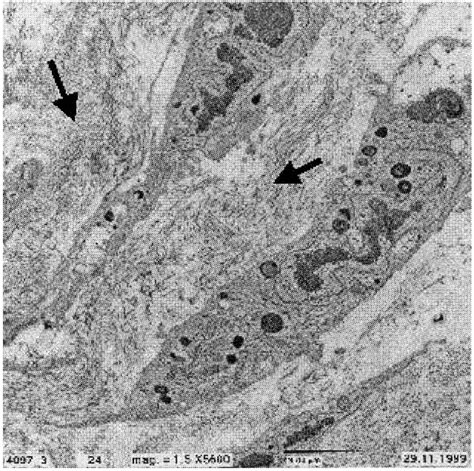 Figure 3 From Fibrin Gel Advantages Of A New Scaffold In Cardiovascular Tissue Engineering Q