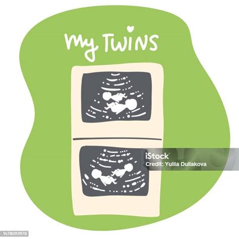 임신 초음파 흑백 사진 자궁에있는 아기 작은 아기 실루엣 의료 사진 임산부 클리닉 검사 배아 인간 벡터 삽화 초음파 검사 배꼽 스캔 개념에 대한 스톡 벡터 아트 및 기타