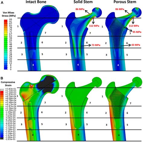How To Design A Graded Hybrid Porous Hip Implant Stem To Reduce Stress Shielding And Bone Resorption