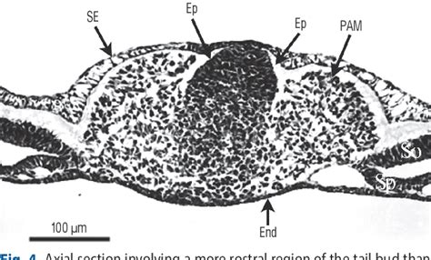 Figure 1 From Overview Of Secondary Neurulation Semantic Scholar