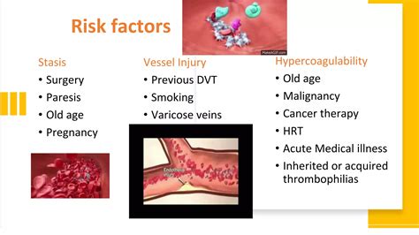 Dvt Prophylaxis In Orthopaedic Surgery Pptx
