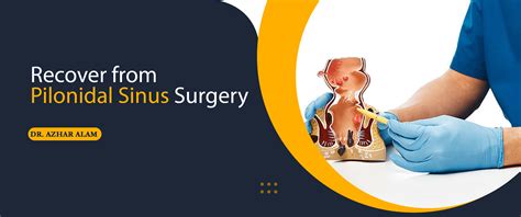 Recover From Pilonidal Sinus Surgery Pilonidal Sinus Doctor