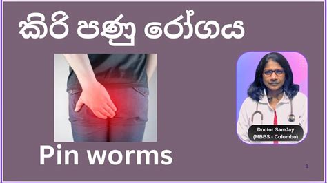 කිරි පණු රෝගයට බෙහෙත් Pin Worm Infection Sinhala Youtube