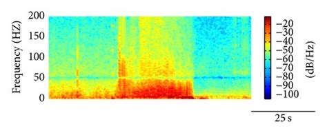 Lfps And The Corresponding Power Spectral Of Seizures In One Example