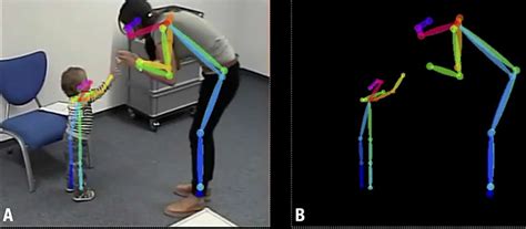 Using AI Scientists Developed A Device To Detect Autism