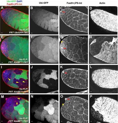 Abd B In The Adult Testis Spermatocytes Does Not Affect Integrin Download Scientific Diagram