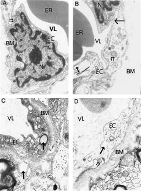 The Ultrastructural Characteristics Of Brain Microvessels From Ad