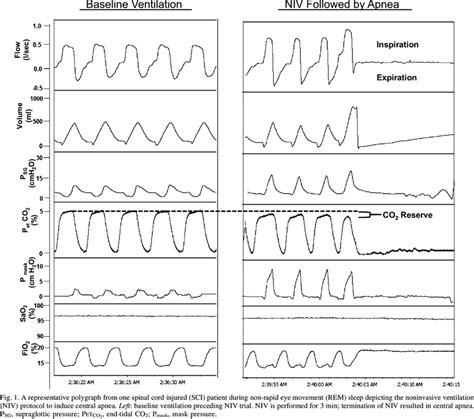 Minute Ventilation Coefficient Of Variation However Download Table