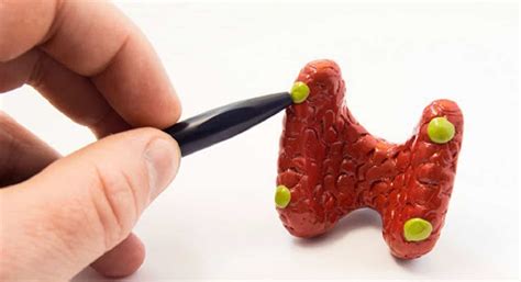 از علت تا درمان پرکاری پاراتیروئید