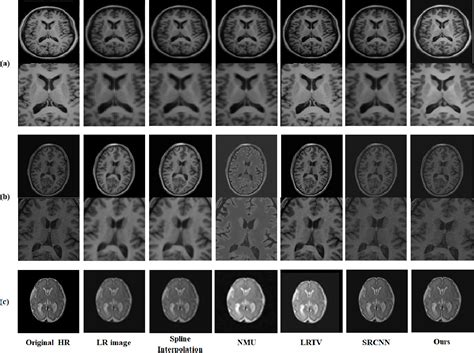 Figure 1 From Deep Robust Residual Network For Brain Mri Super Resolution Semantic Scholar