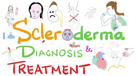Scleroderma Diagnosis And Management YouTube