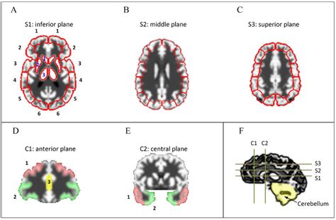Illustration Of The 51 Target Rois For Quantitative Analysis Panels Download Scientific