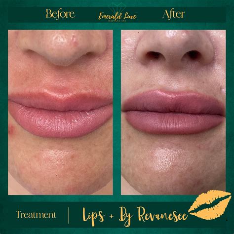 Luxe Body Emerald Luxe Medspa