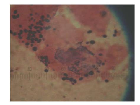 Cryptococcus PPTX