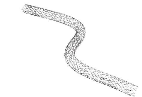 Optimeds Tentos 4 F Stent System Launched In Europe And Other Ce Mark Countries Endovascular