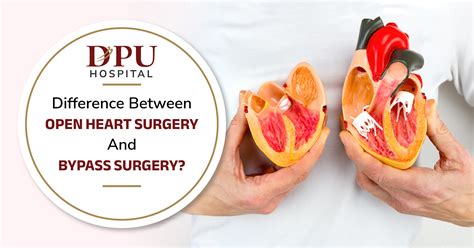 Difference Between Open Heart Surgery And Bypass Surgery Dpu Hospital