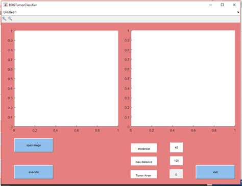 Segmentation Of Lung Ct Images And Nodule Detection With Matlab