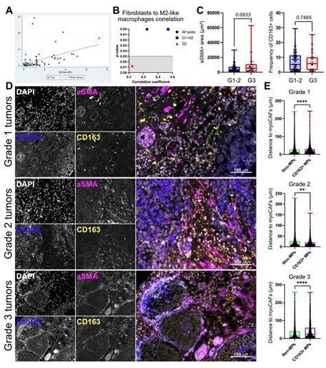 Fibroblast Macrophage Interactions Decrease In High Grade Nmibc A Download Scientific Diagram