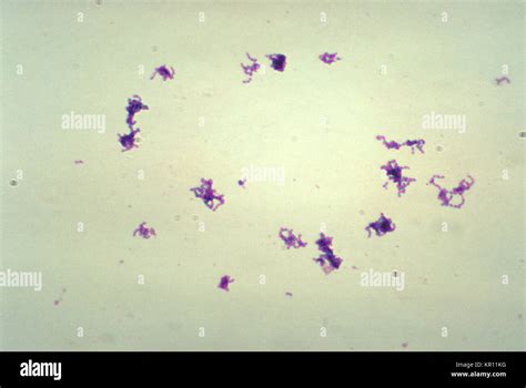 Gram Positive Spore Forming Bacilli