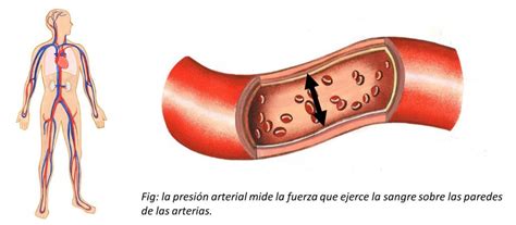 Hipertensión Arterial