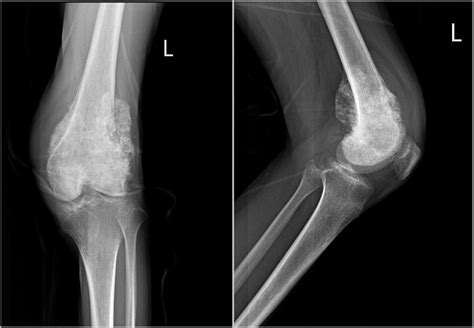 ГССҮТ ИЙН ЭМЧ НАР ЯСНЫ ХОРТ ХАВДАРТАЙ ХЭСГИЙГ БҮРЭН АВЧ ХИЙМЭЛ ЯС ҮЕ