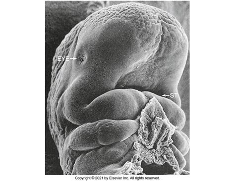 Oral Embryology Oral Facial Anatomy Online