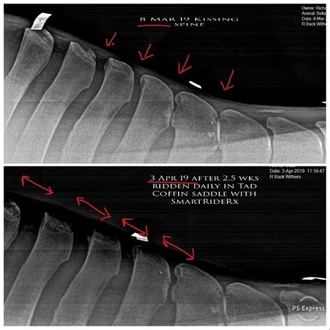 X Ray Kiss