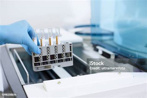 의료 연구 실험실에서 실험실 의료 샘플 현대 장비를 사용 하 여 작업 하는 과학자 손을 닫습니다 실험실에 대 한 의료 장비 의료 기기 분석 합니다 혈액은 에이즈 및 기타