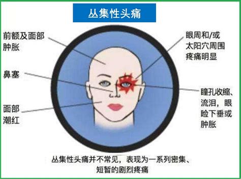 头痛劳损与慢性疼痛 生命周期健康 法道营养草本网站
