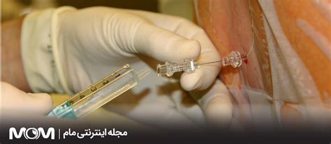 بی‌حسی اسپینال چیست؟