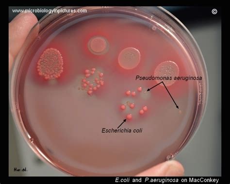 Pseudomonas Aeruginosa On Macconkey Agar