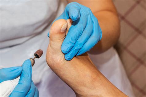 전문 하드웨어 페디큐어 전기 기계를 사용 하 여입니다 환자 의료 페디큐어 절차에 Podiatrist를 방문입니다 특별 한 전기 장치 피트를 필 링 발 스파 살롱에서 치료