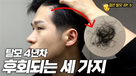 내 탈모를 더 심하게 만든 3가지 실수들😔 젊은탈모 최종화 Youtube