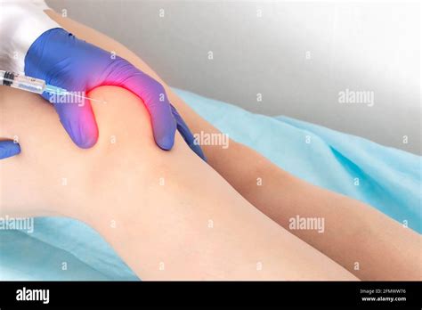 The Doctor Makes A Puncture With Intra Articular Injection Of Drugs Into The Patient S Knee